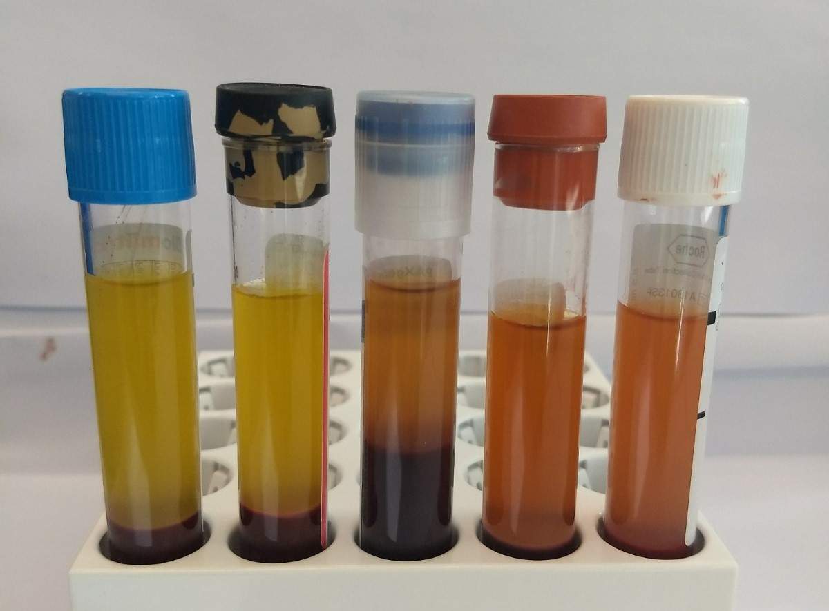 Using the blood to reveal tumor secrets | OncoRNALab